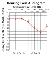 How is hearing measured? – Discovery of Sound in the Sea